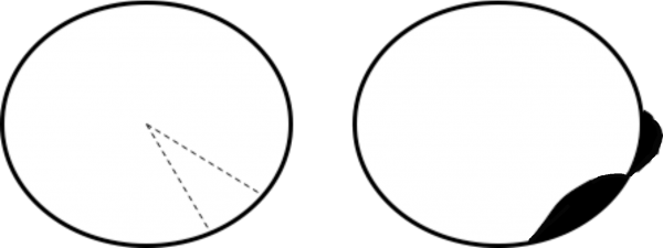 Why and when? - Consequential LCA